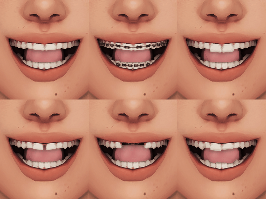 Sestro Teeth - Gallery - The Sims 4 Create a Sim - CurseForge