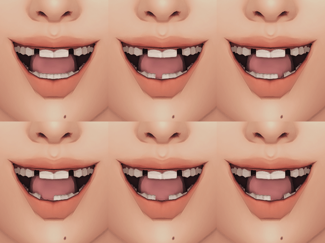 Teeths Childs 01 - Gallery - The Sims 4 Create a Sim - CurseForge
