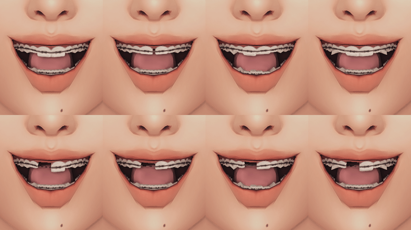 Teeths Braces 01 Child - The Sims 4 Create a Sim - CurseForge