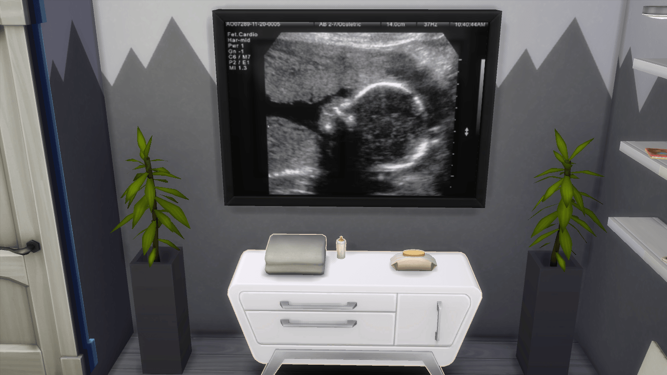 Stages of Pregnancy Ultrasounds Wall Art - The Sims 4 Build / Buy ...