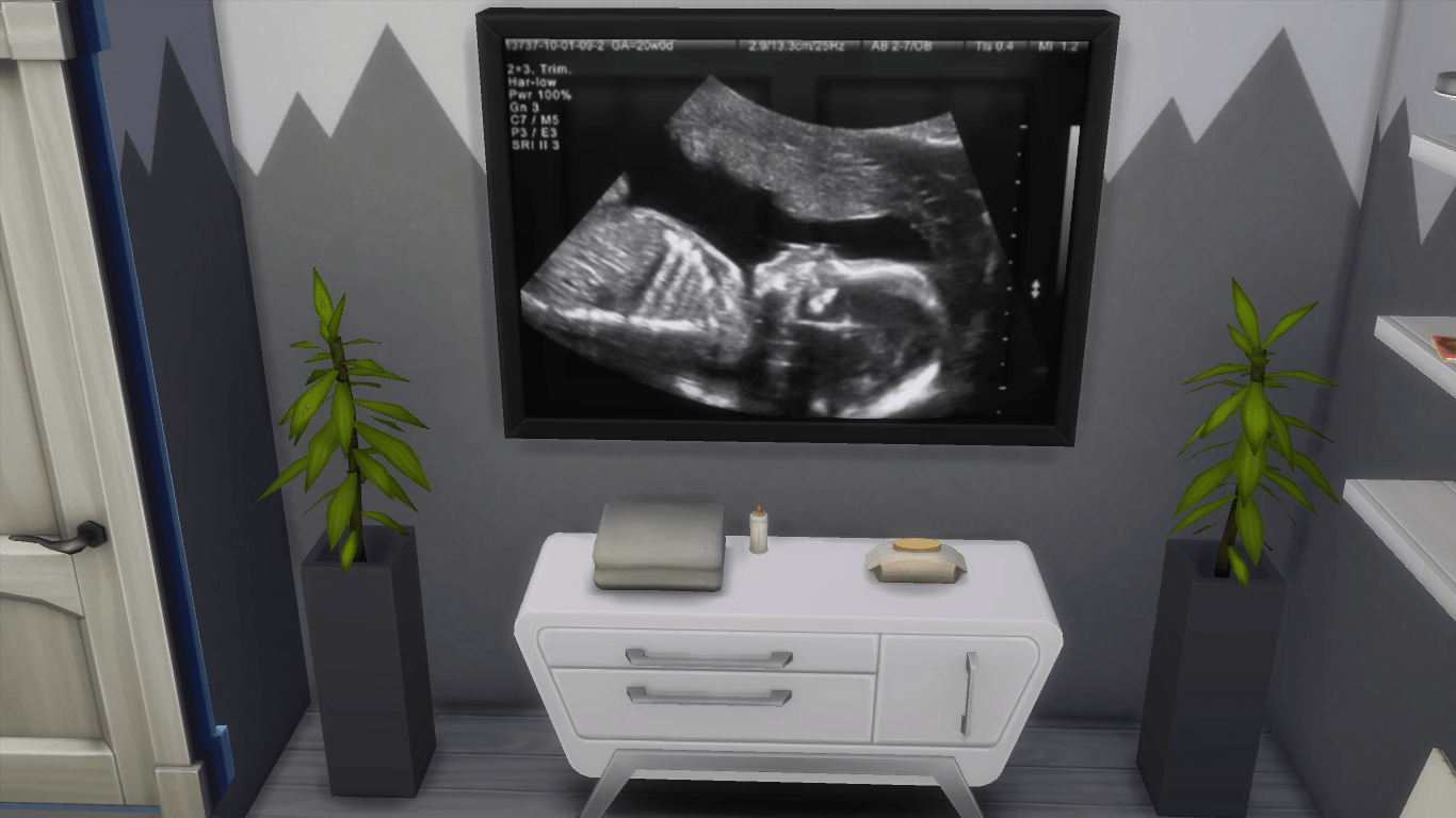Stages of Pregnancy Ultrasounds Wall Art - The Sims 4 Build / Buy ...