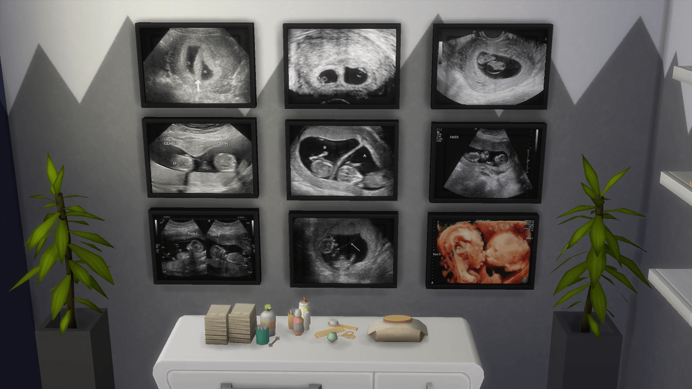 Twin Pregnancy Ultrasound Swatches - The Sims 4 Build / Buy - CurseForge