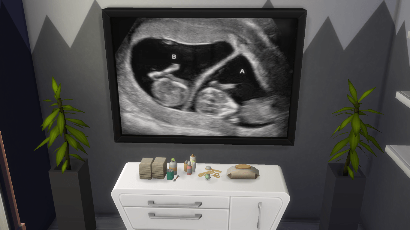 Twin Pregnancy Ultrasound Swatches - The Sims 4 Build / Buy - CurseForge