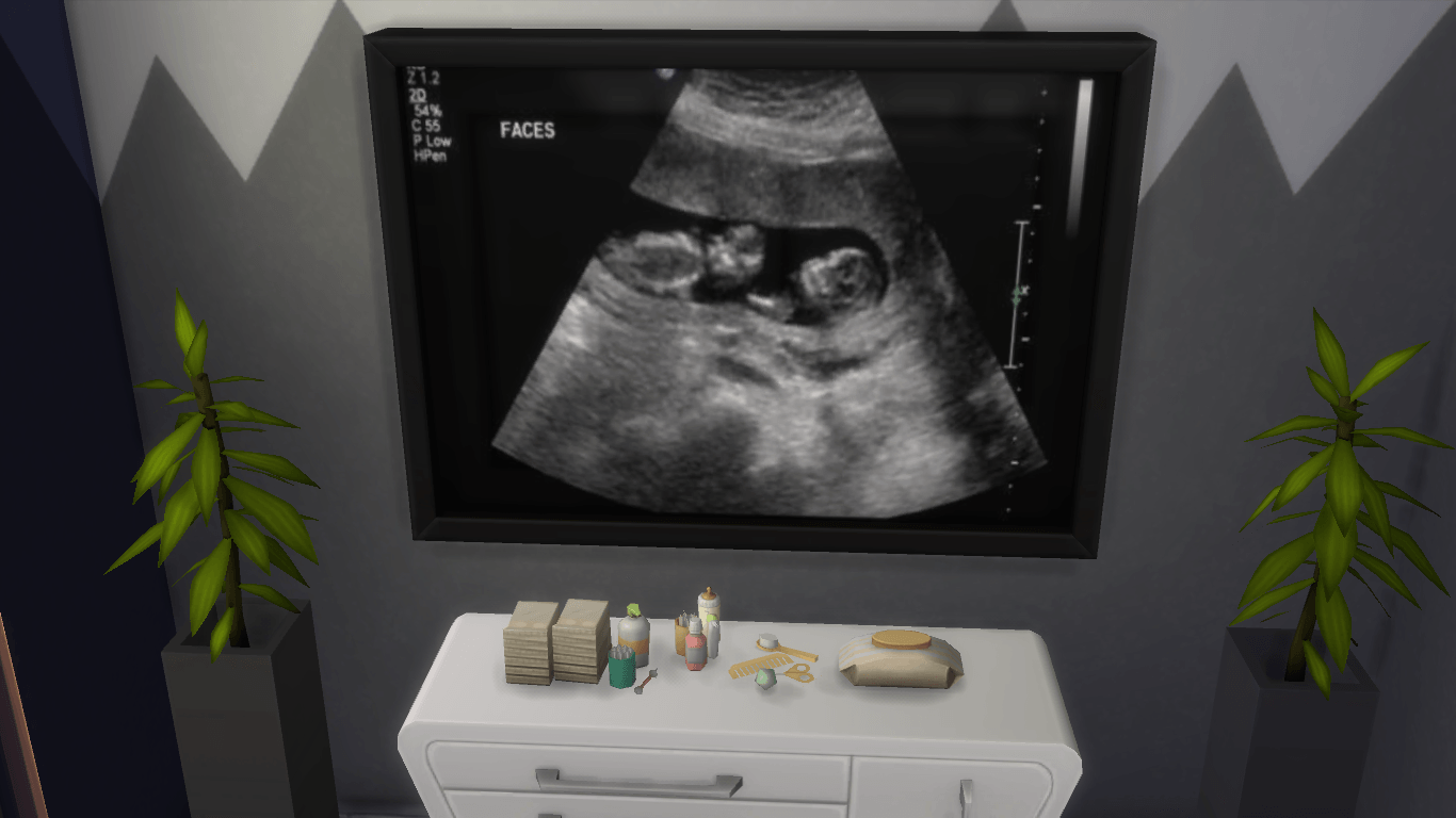 Twin Pregnancy Ultrasound Swatches - The Sims 4 Build / Buy - CurseForge