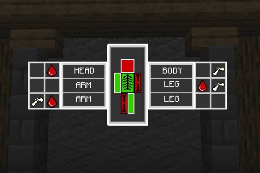 Install Injuries and Treatments - Minecraft Mods & Modpacks - CurseForge