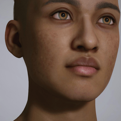 "Pretty Natural" Acne Textured Skin (Male) - inZOI Create a Zoi ...