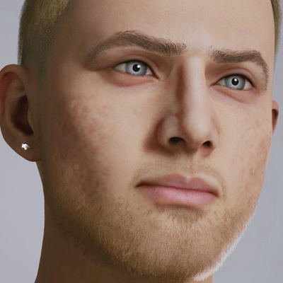 "Pretty Natural" Acne Textured Skin (Male) - inZOI Create a Zoi ...