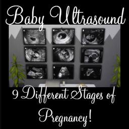 Stages of Pregnancy Ultrasounds Wall Art - The Sims 4 Build / Buy ...
