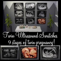 Twin Pregnancy Ultrasound Swatches - The Sims 4 Build / Buy - CurseForge