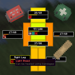 Medical system - File - Minecraft Mods - CurseForge